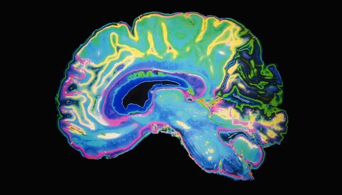 Brain Scans Suggest Drums And Bass Change How The Brain Hears Pop Music ...